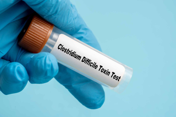 Informatii despre infectia cu Clostridium difficile